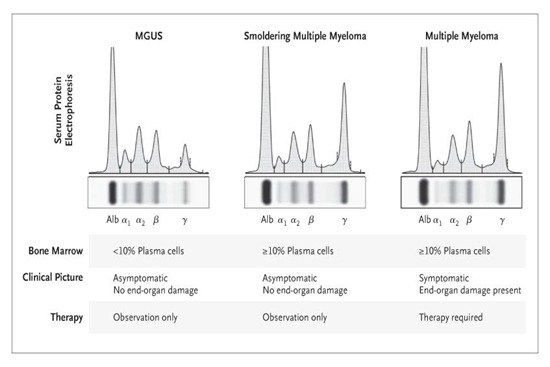 Health-related Topics : Medical Biochemistry Tips (10): Serum Protein ...